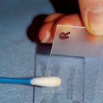 An introduction to ear cytology in small animal patients
