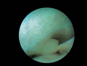 Treatment of otitis externa, media and interna in rabbits