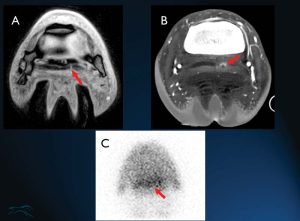 Navicular syndrome: causes, diagnosis and treatment