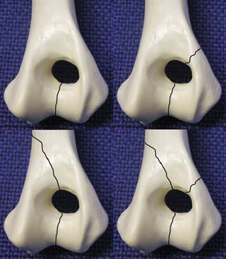 Update on humeral condylar fracture treatment in dogs