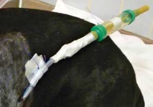 How to drain pleural cavity