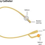Urinary catheters in dogs – placement and maintenance tips