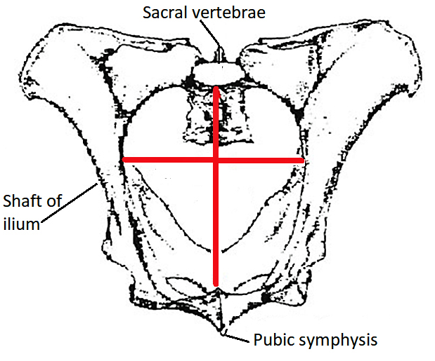 Techniques in accurate pelvic measurement of beef heifers