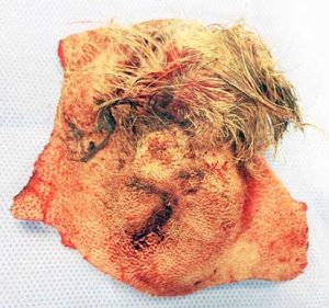 Screw tail and tail fold pyoderma – medical and surgical updates