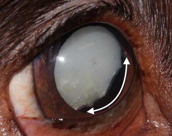 Canine cataracts: classification, aetiology and complications