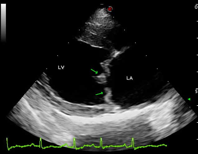 Mitral valve disease: timeline of a degenerative condition in dogs