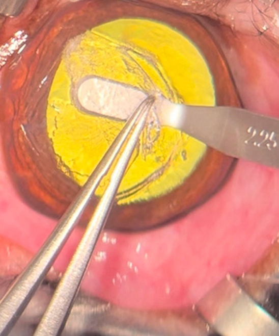 Corneal ulcers in dogs