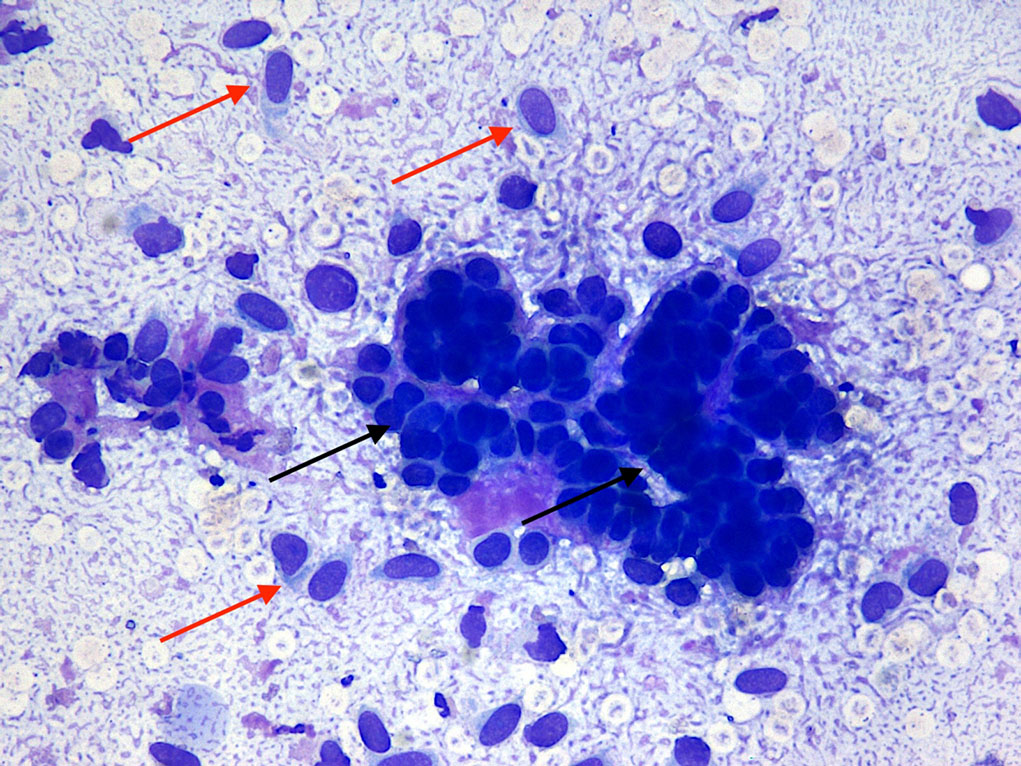 Cytology findings from a skin nodule in adult dog